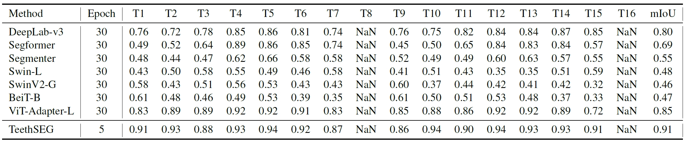 Teeth-SEG: An Efficient Instance Segmentation Framework for Orthodontic ...