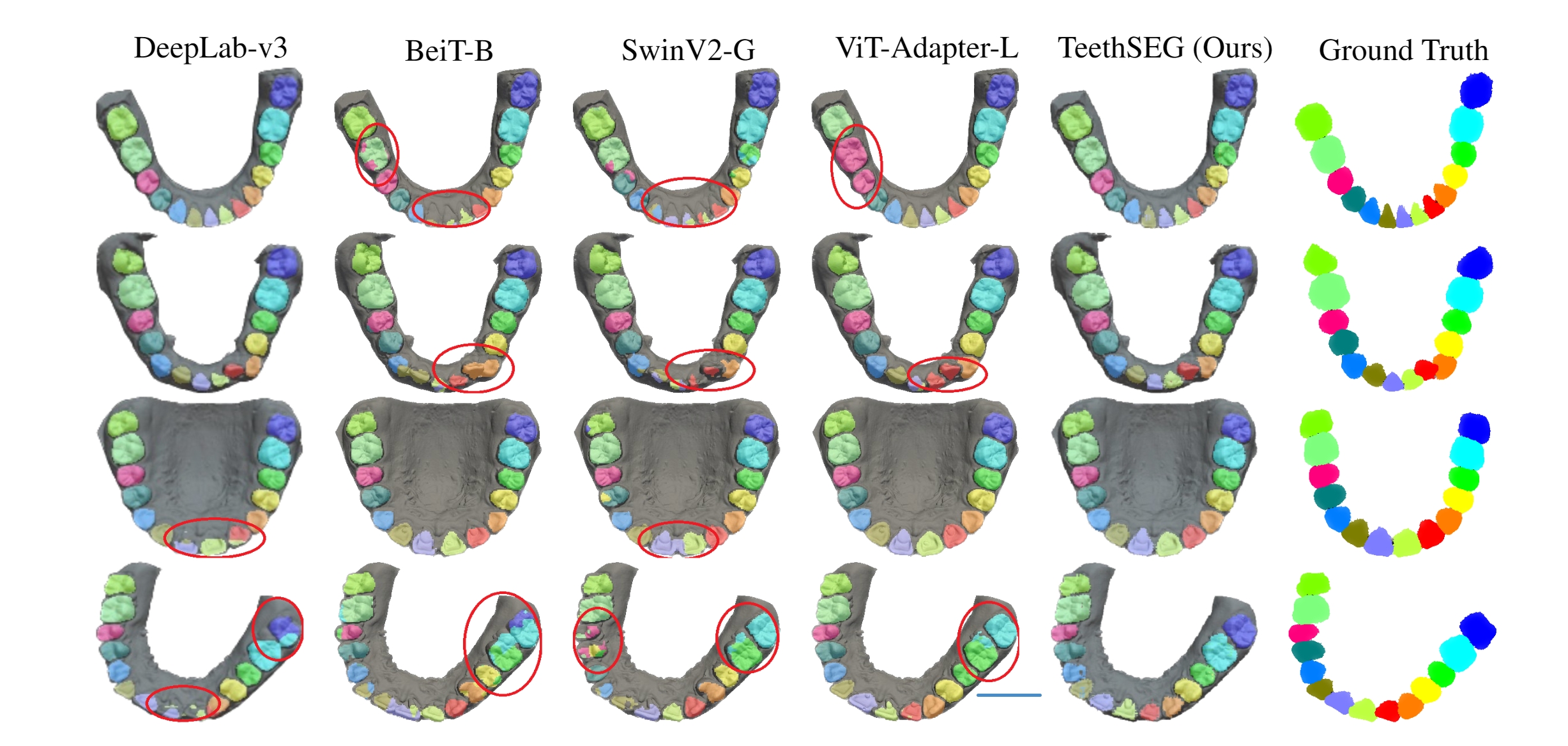 Teeth-SEG: An Efficient Instance Segmentation Framework for Orthodontic ...